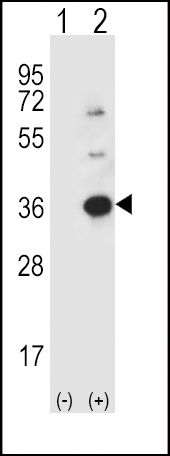 Caspase-3 (CASP3) Antibody (Center) - Purified Rabbit Polyclonal ...