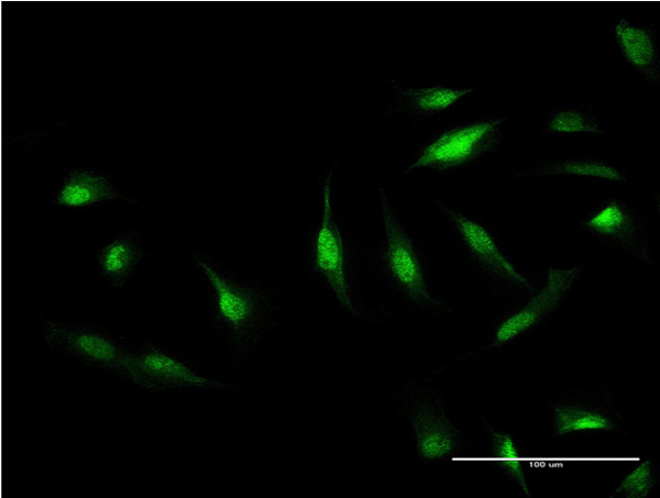 CAND1 Antibody (monoclonal) (M05) - Mouse monoclonal antibody raised ...