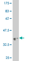 HELZ Antibody (monoclonal) (M02) - Mouse monoclonal antibody raised ...