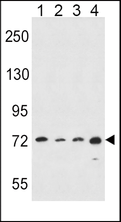 ALOX15 Antibody (C-term) - Purified Rabbit Polyclonal Antibody (Pab) WB ...