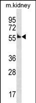 Mouse Ccna1 Antibody (Center) - Affinity Purified Rabbit Polyclonal ...