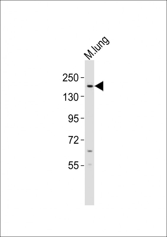 KDM6B Antibody (Center) - Purified Rabbit Polyclonal Antibody (Pab) WB ...