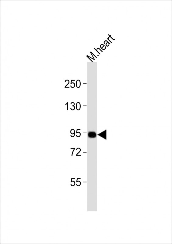 (Mouse) Uhrf1 Antibody (C-term) - Purified Rabbit Polyclonal Antibody ...