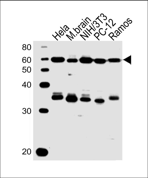 Pyruvate Kinase (PKM2) Antibody (C-term) - Purified Rabbit Polyclonal ...
