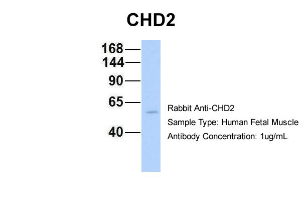 CHD2 antibody - N-terminal region - Rabbit Polyclonal Antibody WB - Buy ...