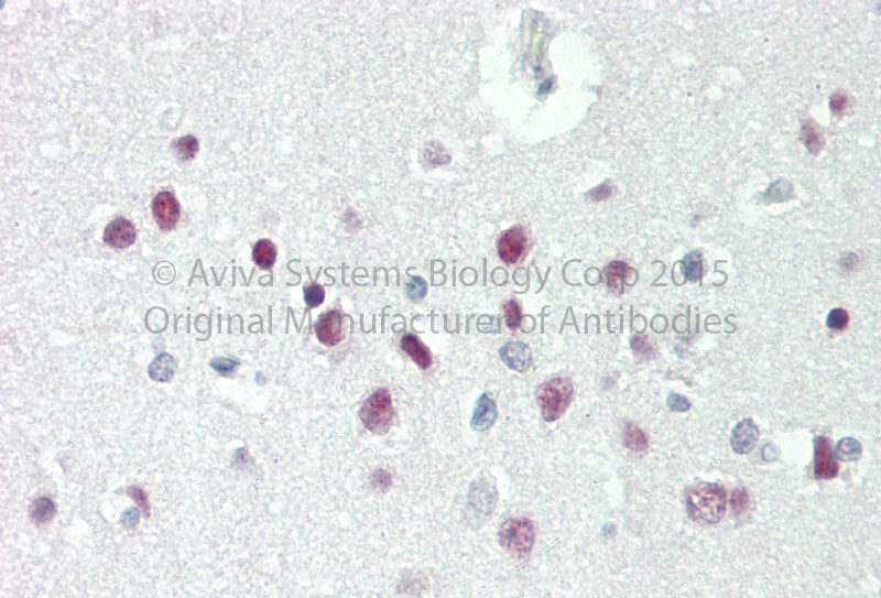 TBX15 antibody - C-terminal region - Rabbit Polyclonal Antibody WB, IHC ...