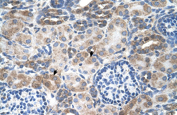 SLC14A1 antibody - C-terminal region - Rabbit Polyclonal Antibody WB ...