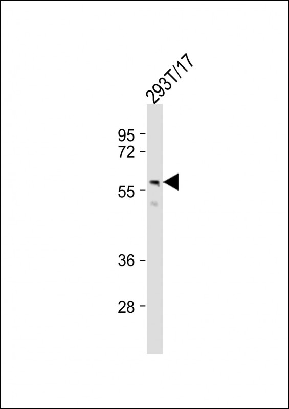 PTDSS1 Antibody (C-term) - Purified Rabbit Polyclonal Antibody (Pab) WB ...
