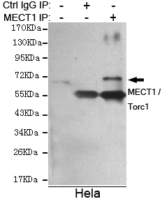 MECT1 / Torc1 Antibody - Purified Mouse Monoclonal Antibody (Mab) WB ...