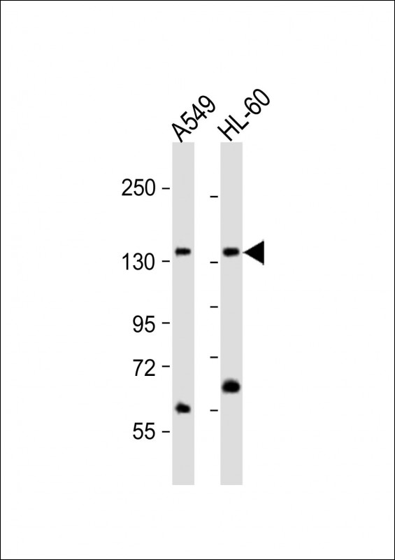AFF1 Antibody (C-term) - Purified Rabbit Polyclonal Antibody (Pab) WB ...