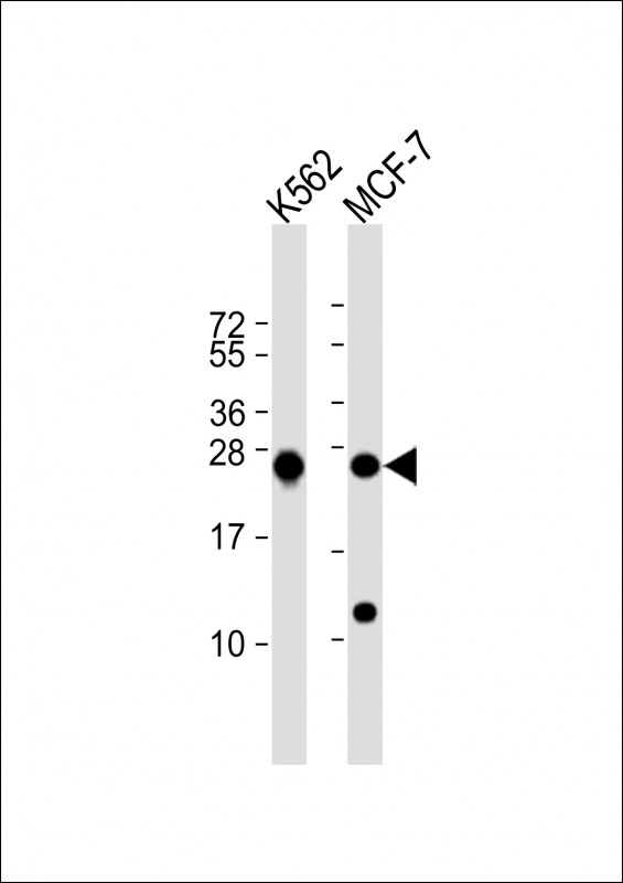 PSMB1 Antibody (C-term) - Affinity Purified Rabbit Polyclonal Antibody ...