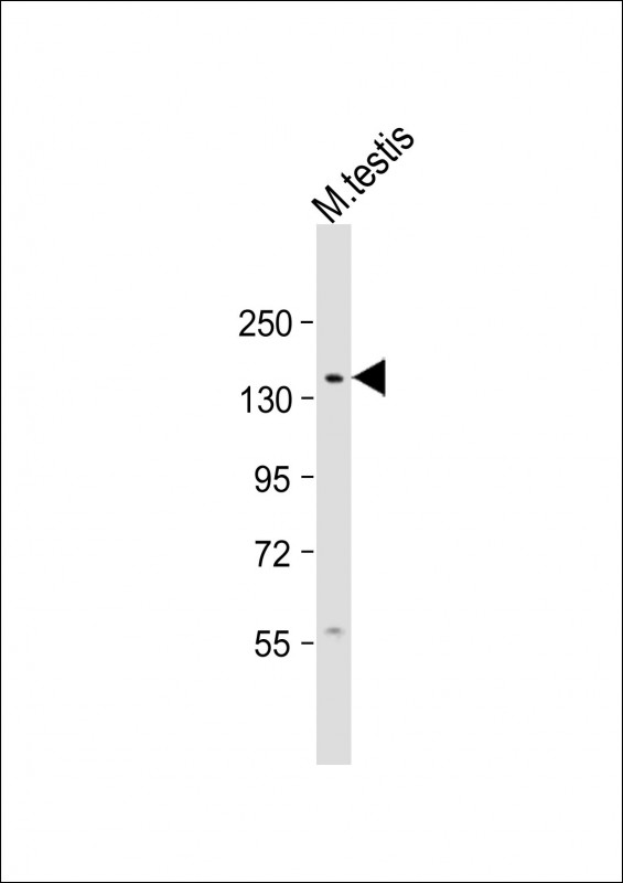 Mouse Cdk13 Antibody (N-term) - Affinity Purified Rabbit Polyclonal ...