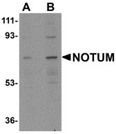 NOTUM Antibody - WB, IF, E, IHC-P - Buy Now!