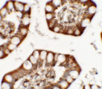 ZFX Antibody - WB, IF, E, IHC-P - Buy Now!