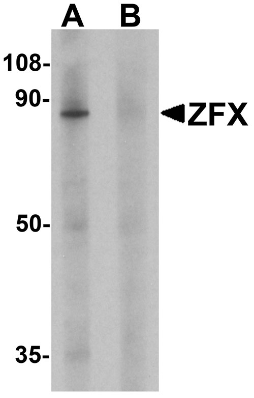ZFX Antibody - WB, IF, E, IHC-P - Buy Now!