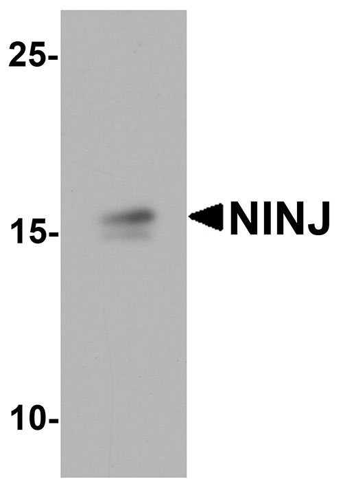 NINJ1 Antibody - WB, IF, E, IHC-P - Buy Now!