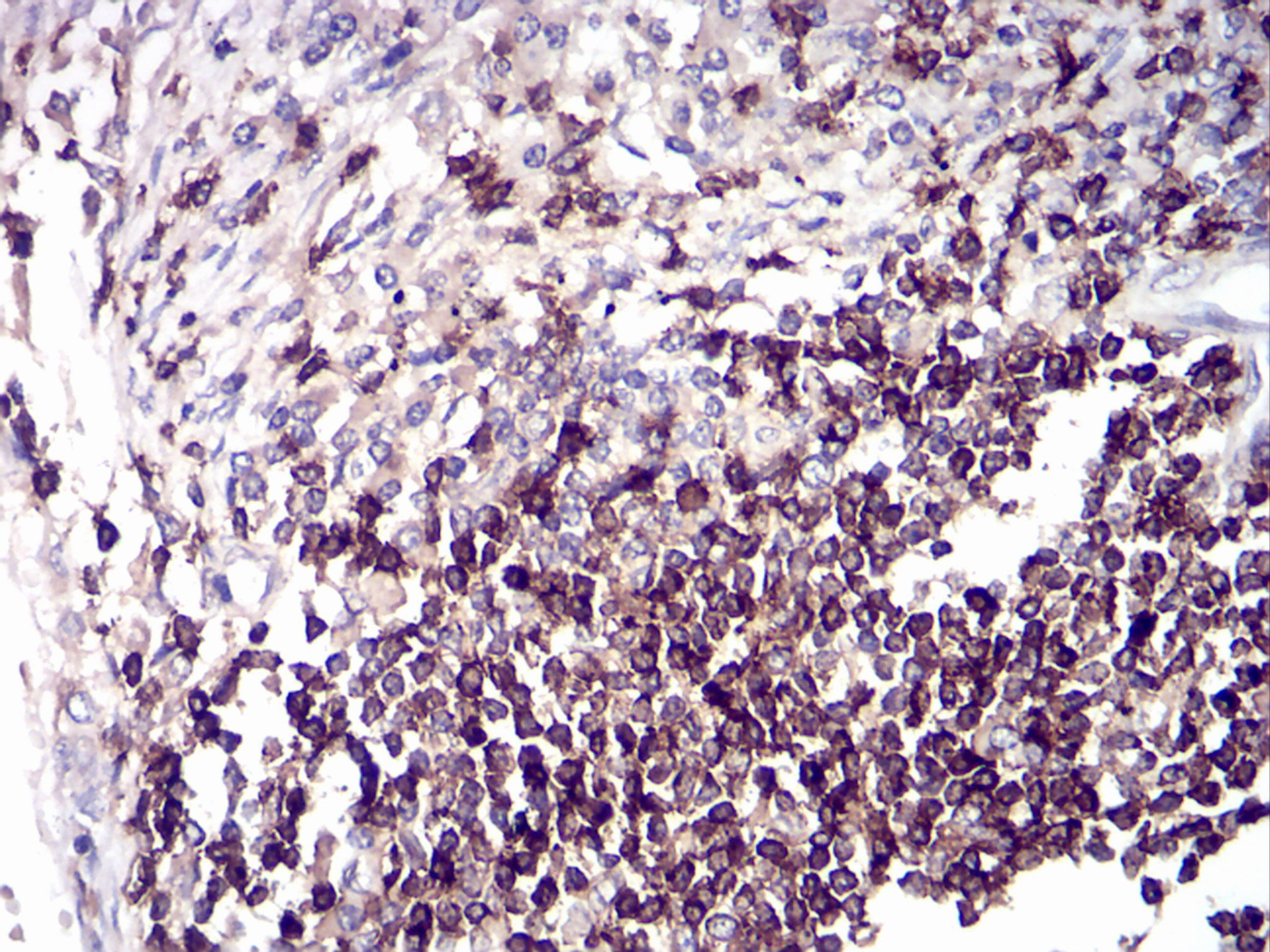 CD6 Antibody - Purified Mouse Monoclonal Antibody WB, IHC, FC, ICC, E ...
