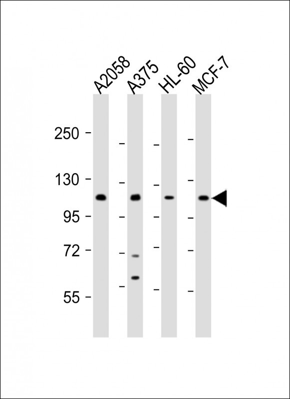 COL17A1 Antibody (Center) - Affinity Purified Rabbit Polyclonal ...
