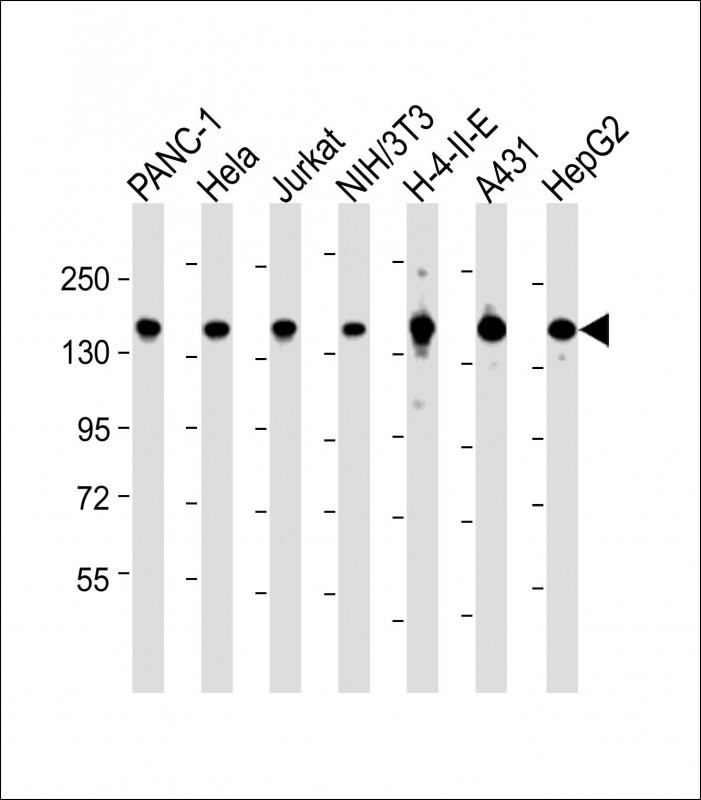 SF3B1 Antibody (N-term) - Affinity Purified Rabbit Polyclonal Antibody ...