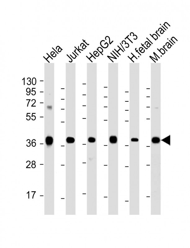 MATH1/HATH1/ATOH1 Antibody (N-term) - Affinity Purified Rabbit ...
