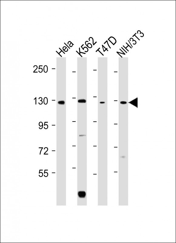 ROR2 Antibody (C-term) - Purified Rabbit Polyclonal Antibody (Pab) WB ...