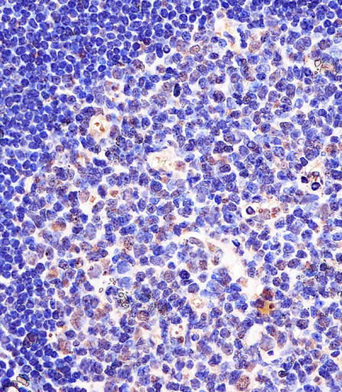 SF3B1 Antibody (N-term) - Affinity Purified Rabbit Polyclonal Antibody ...