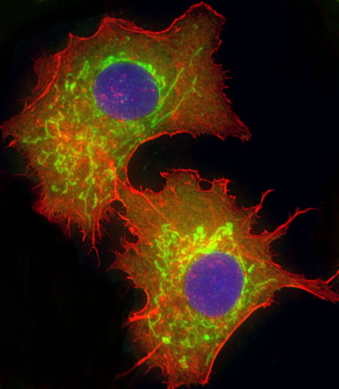 GLS Antibody (C-term) - Peptide Affinity Purified Rabbit Polyclonal ...