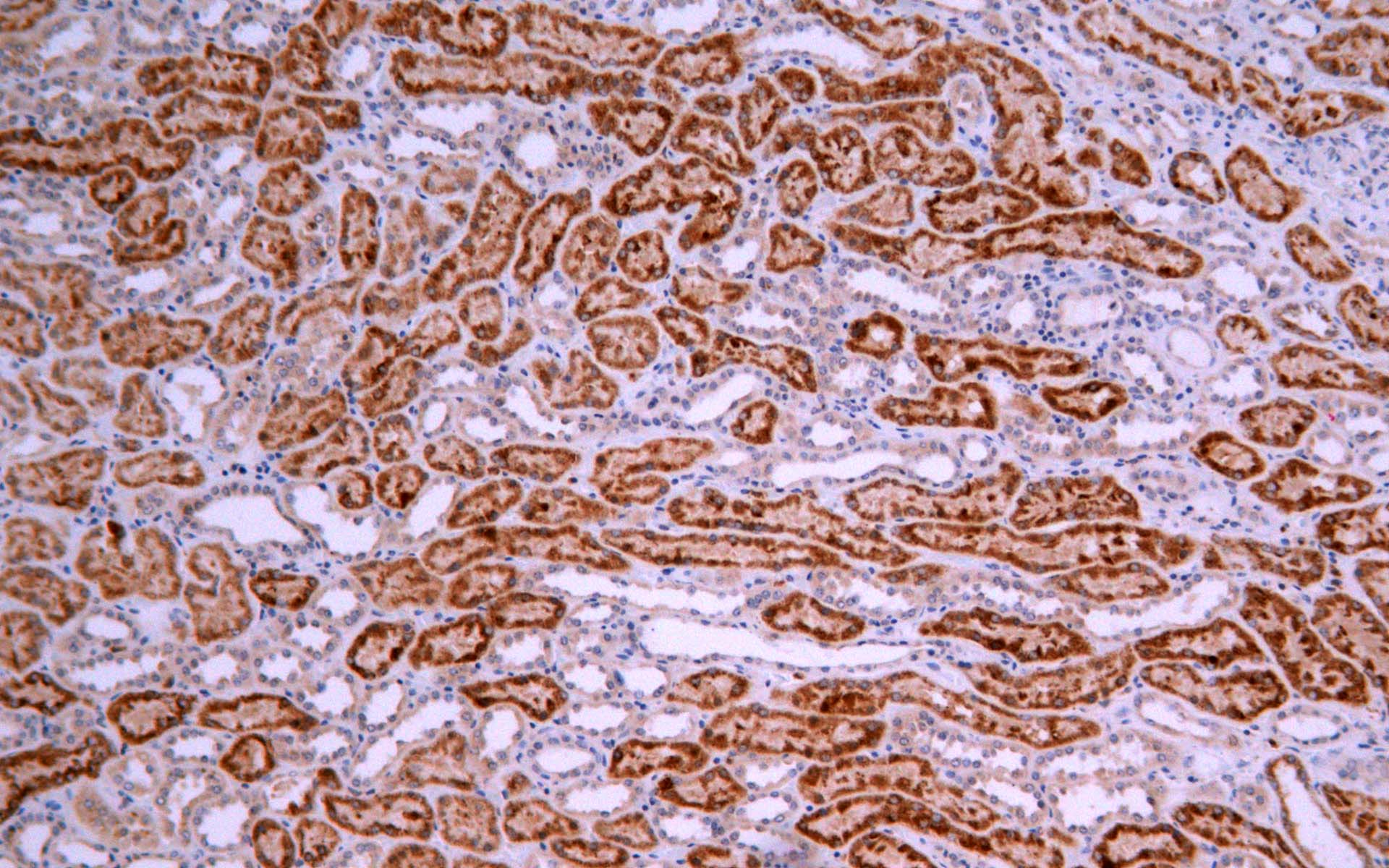 AMACR/p504s Antibody - Mouse Monoclonal Antibody (Mab) IHC - Buy Now!