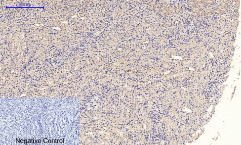 PI 3-kinase p85/p55 (phospho Tyr467/199) Polyclonal Antibody - WB, IHC ...