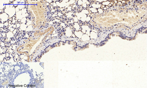PI 3-kinase p85/p55 (phospho Tyr467/199) Polyclonal Antibody - WB, IHC ...