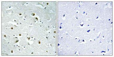 CEP135 Polyclonal Antibody - WB, IHC-P, IF, E - Buy Now!