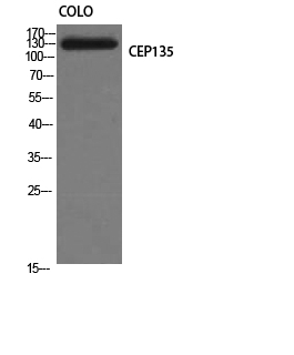 CEP135 Polyclonal Antibody - WB, IHC-P, IF, E - Buy Now!