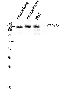 CEP135 Polyclonal Antibody - WB, IHC-P, IF, E - Buy Now!