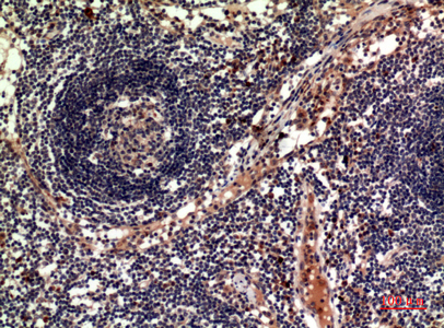 RANKL Polyclonal Antibody - WB, IHC-P - Buy Now!