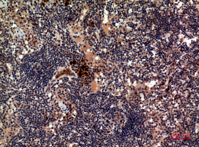 RANKL Polyclonal Antibody - WB, IHC-P - Buy Now!