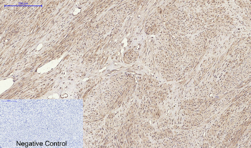 RANKL Polyclonal Antibody - WB, IHC-P - Buy Now!
