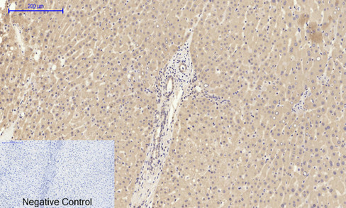 Integrin β3 Polyclonal Antibody - WB, IHC-P - Buy Now!