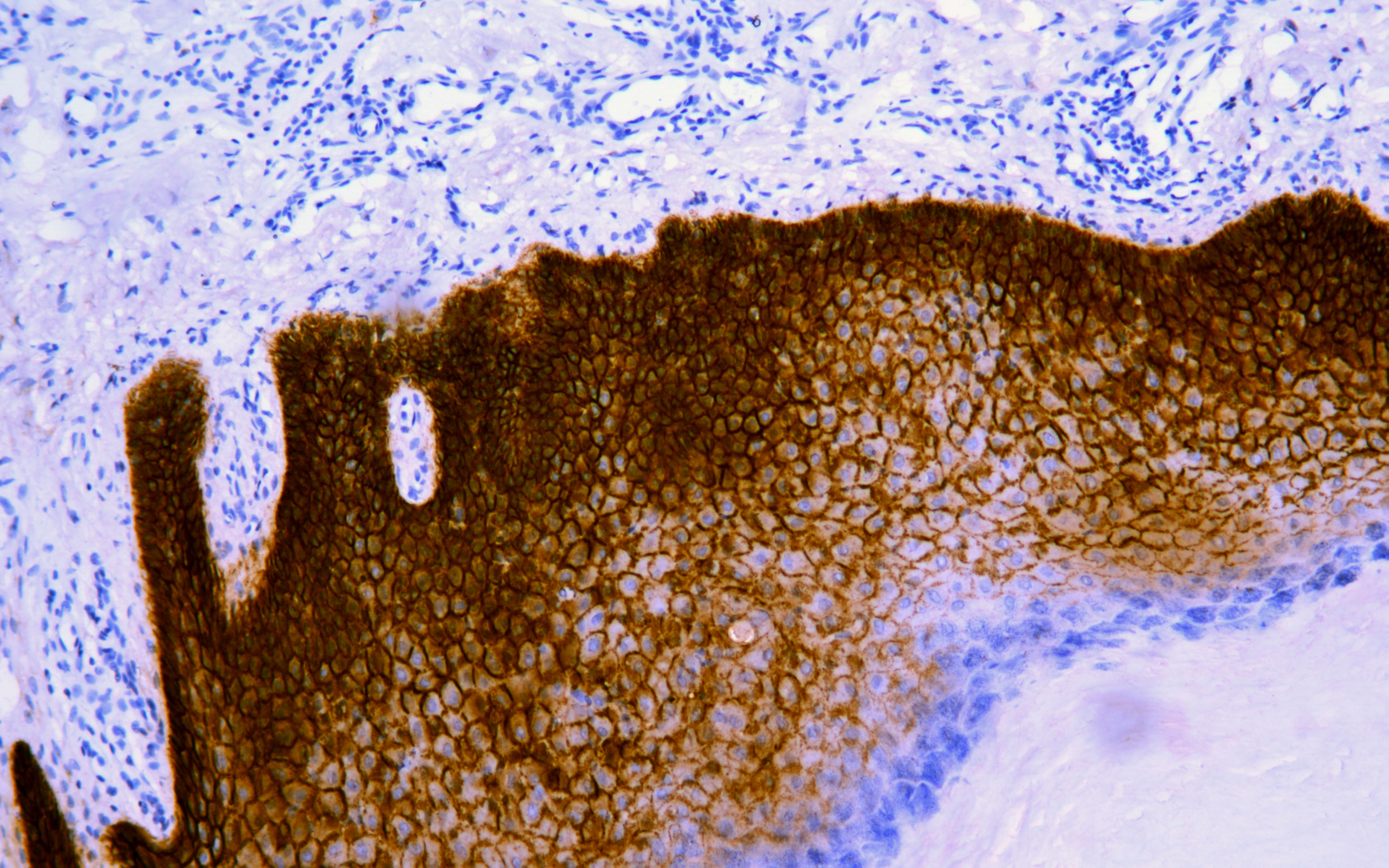 CD138 Antibody - Rabbit Monoclonal Antibody (Mab) IHC - Buy Now!