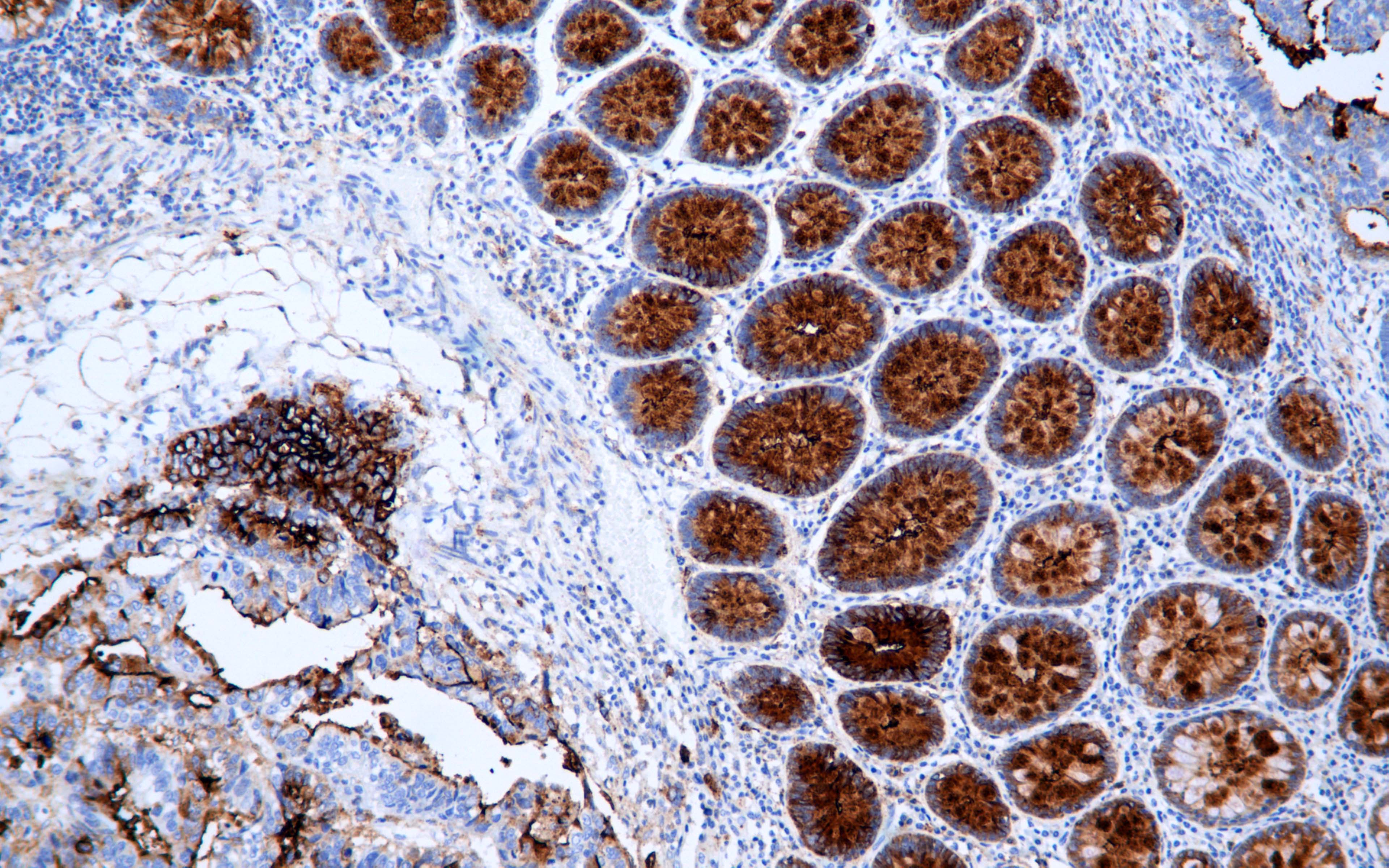 EMA Antibody - Mouse Monoclonal Antibody (Mab) IHC - Buy Now!