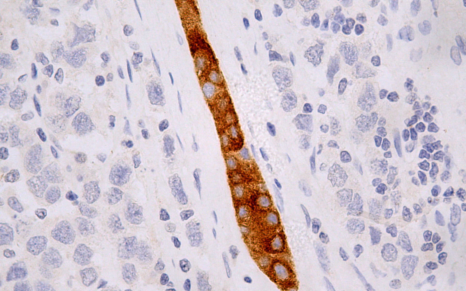 Inhibin, alpha Antibody - Mouse Monoclonal Antibody (Mab) IHC - Buy Now!