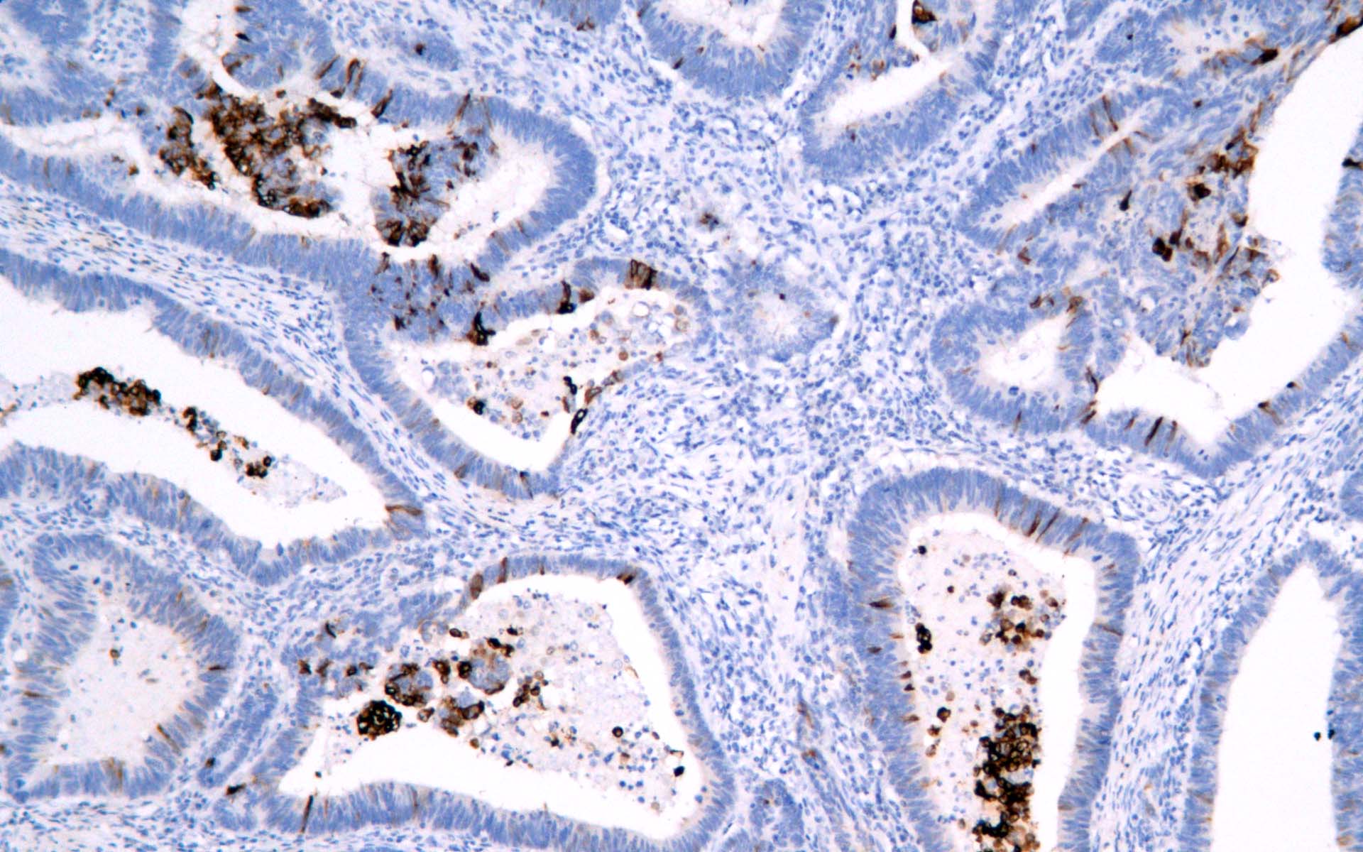 MUC2 Antibody - Mouse Monoclonal Antibody (Mab) IHC - Buy Now!