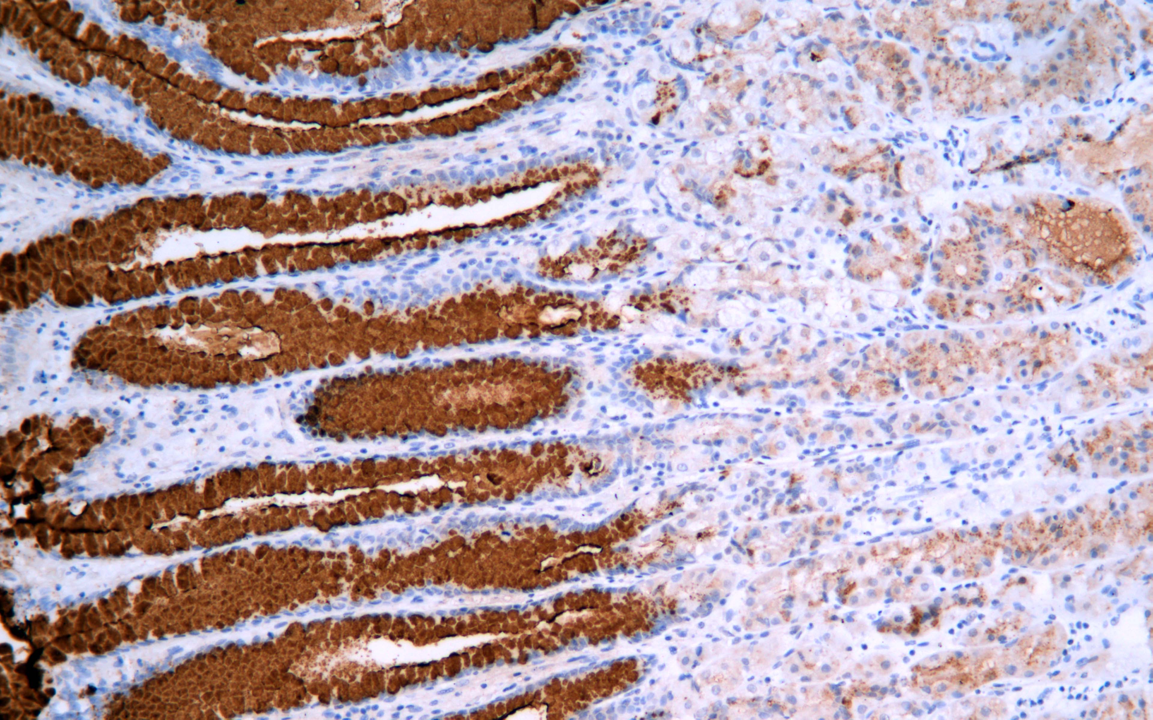 MUC5AC Antibody - Mouse Monoclonal Antibody (Mab) IHC - Buy Now!