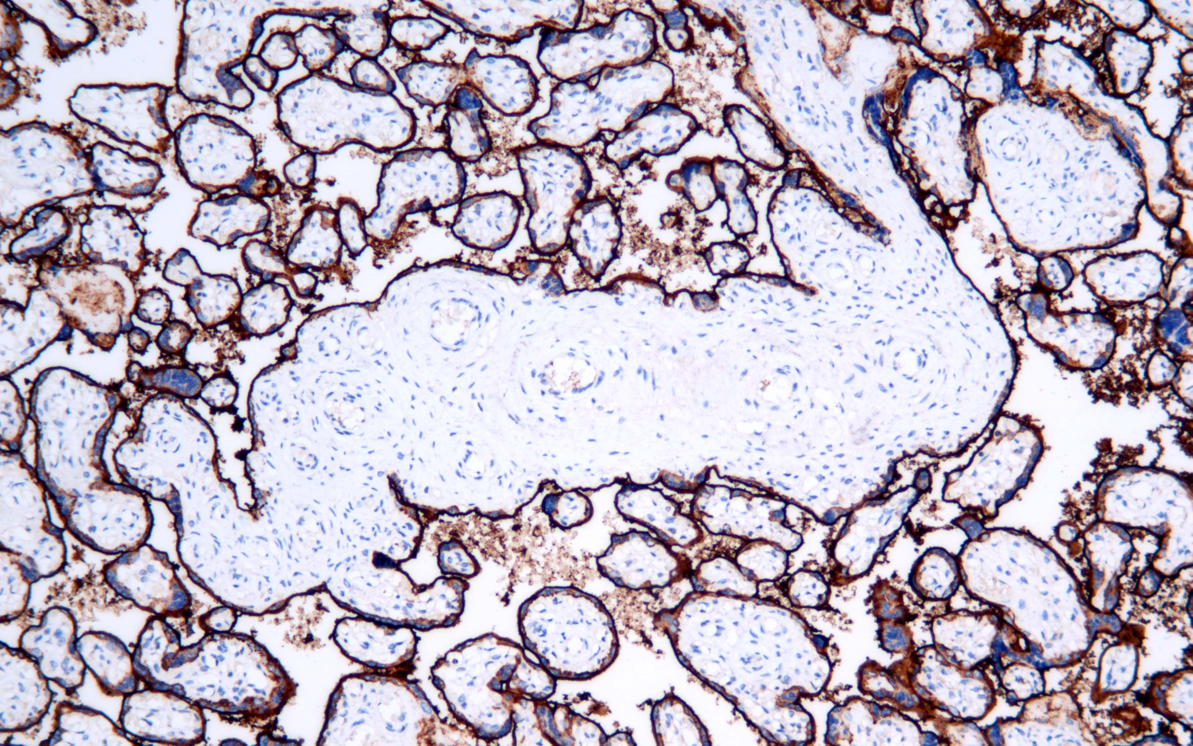 PLAP Antibody - Mouse Monoclonal Antibody (Mab) IHC - Buy Now!