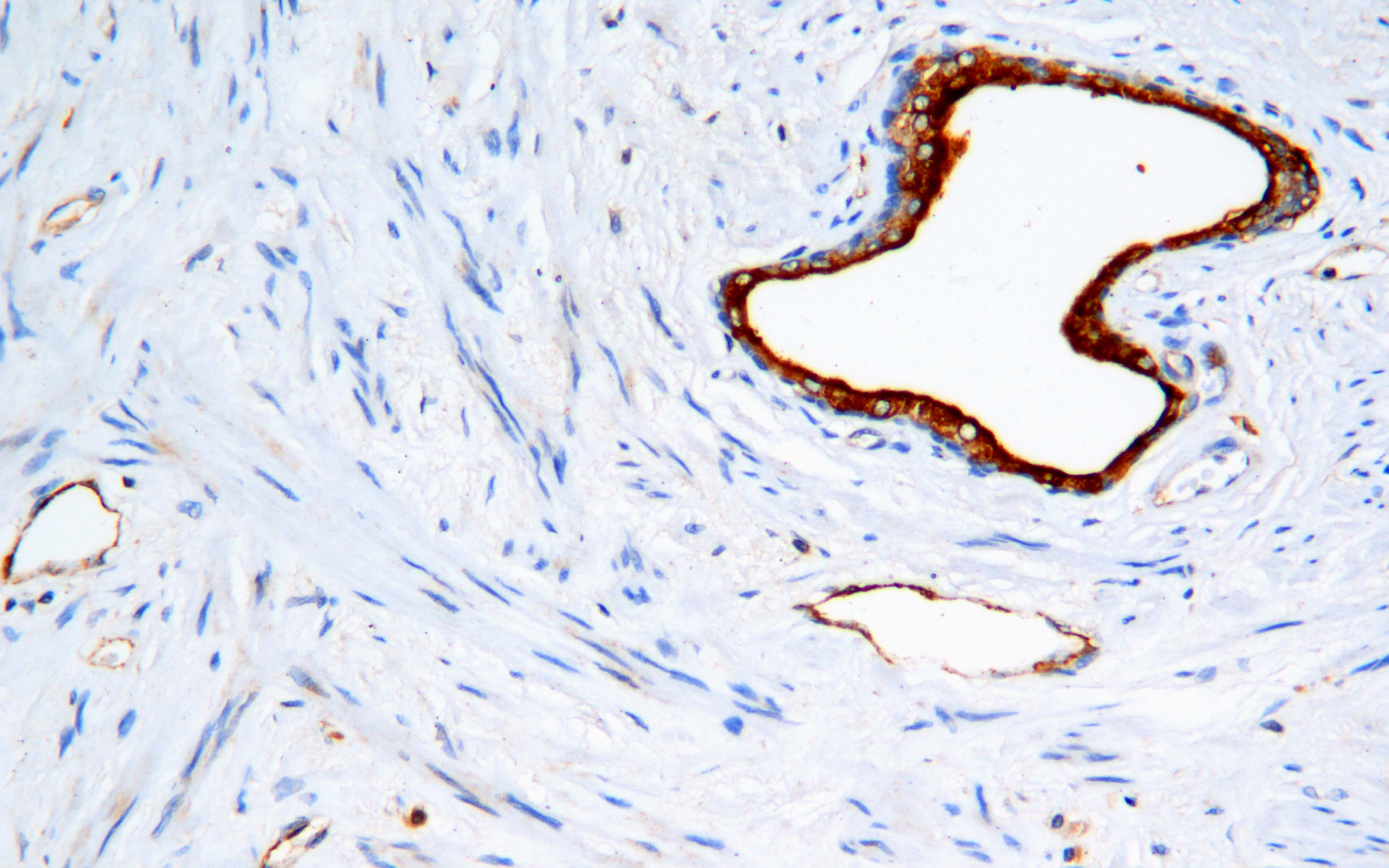 PSMA Antibody - Mouse Monoclonal Antibody (Mab) IHC - Buy Now!