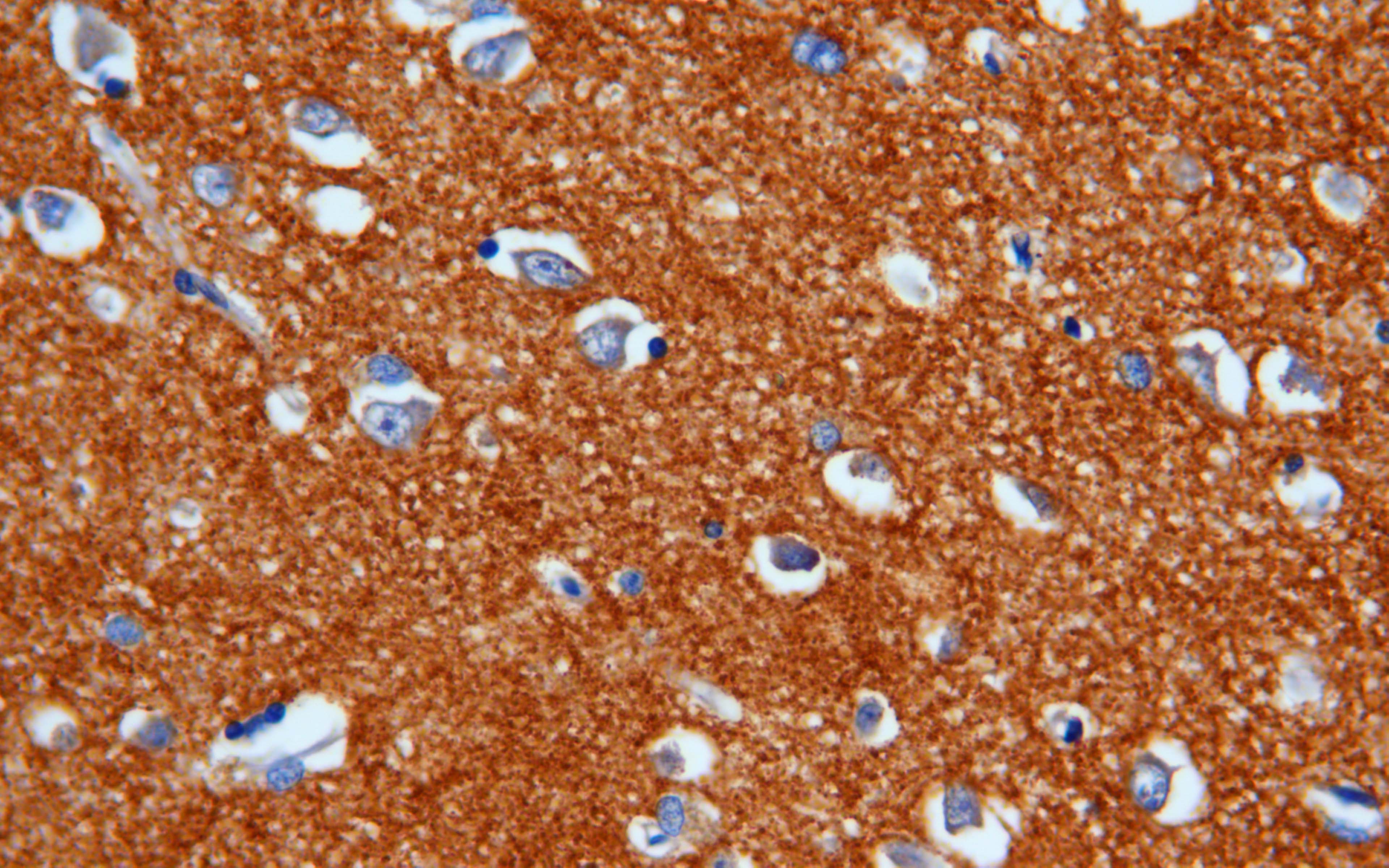 Synaptophysin Antibody - Mouse Monoclonal Antibody (Mab) IHC - Buy Now!