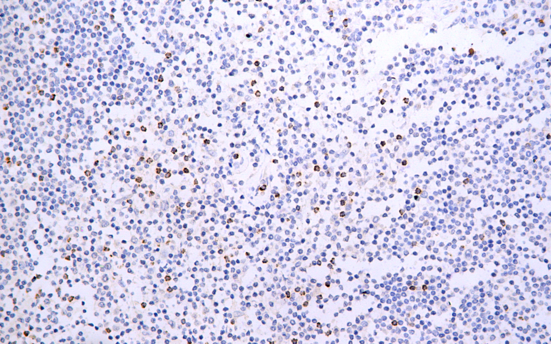 TIA-1 Antibody - Mouse Monoclonal Antibody (Mab) IHC - Buy Now!