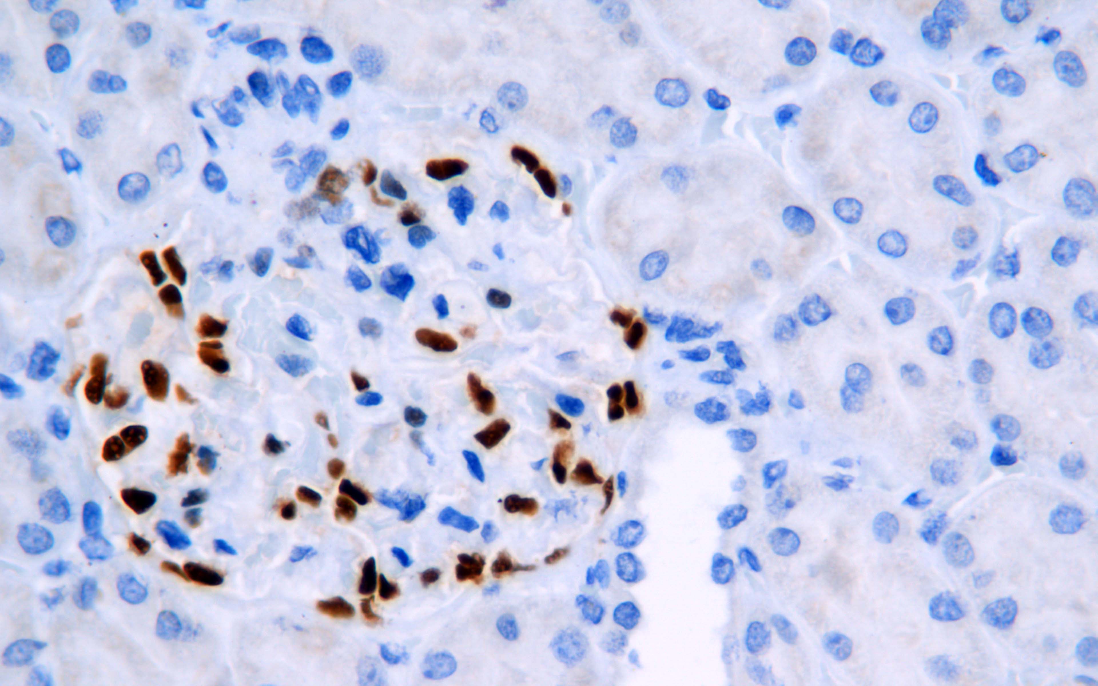 WT1 Antibody - Mouse Monoclonal Antibody (Mab) IHC - Buy Now!