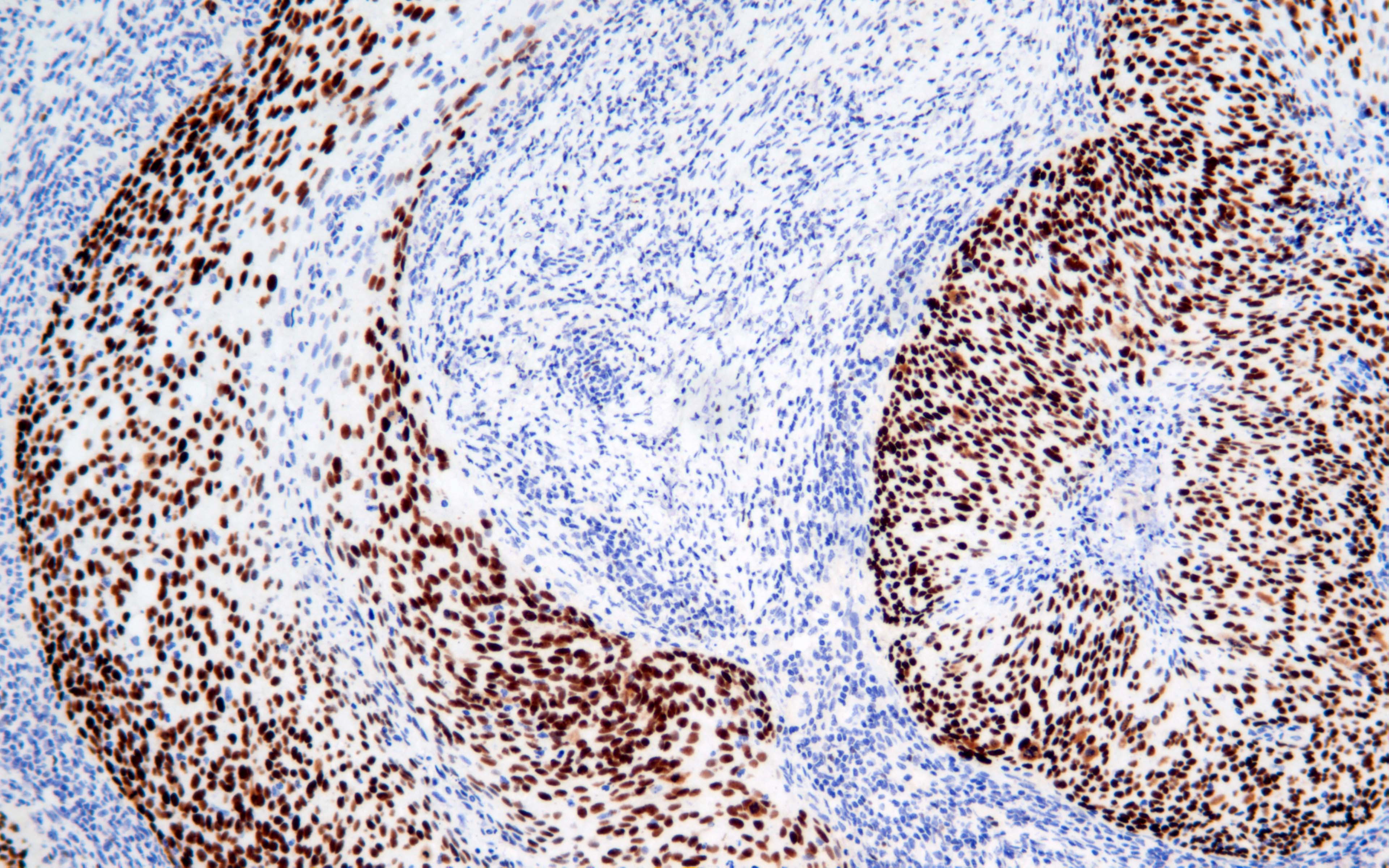 p63 Antibody - Rabbit Monoclonal Antibody (Mab) IHC - Buy Now!