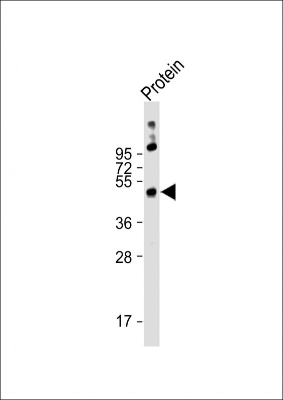 HIS Tag Antibody - Mouse Monoclonal Antibody (Mab) WB, E - Buy Now!