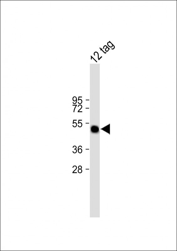 HIS Tag Antibody - Mouse Monoclonal Antibody (Mab) WB, E - Buy Now!